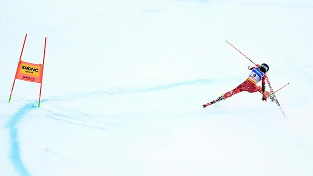 Entwarnung nach Scheibs Sturz: "Das Knie ist stabil" - kicker